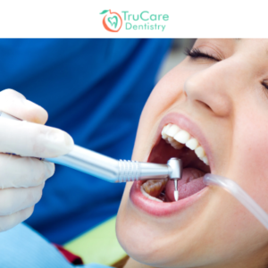 What are the different types of root canal treatment? | Dentist in ...
