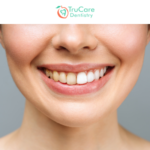 A Guide to Using BEWE for the Screening of Erosive Tooth Wear – TruCare ...