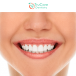 Gum Contouring 101: Why & How It’s Performed, Time, Costs