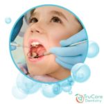 Here’s a Quick Guide to Pulpectomy Procedure – TruCare Dentistry