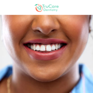 Everything You Need to Know about Craze Lines on Front Teeth | Dentist ...